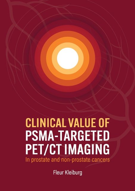 PhD Defence Fleur Kleiburg | Clinical value of PSMA-targeted PET/CT ...